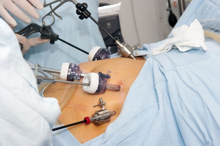 Choosing a bariatric surgery procedure - hospitalninojesus