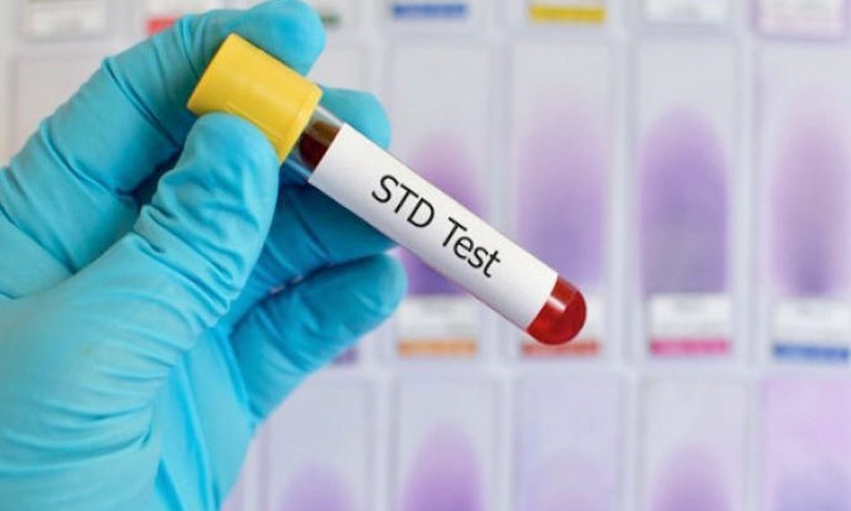 The Best Ways to perform Home STD Tests - hospitalninojesus