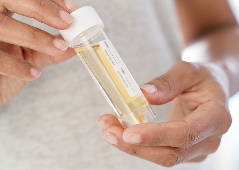 Chlamydia Testing by Urine and Blood Samples - hospitalninojesus