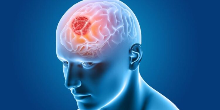 6 Reasons Why Brain Tumors Affect Your Vision - hospitalninojesus