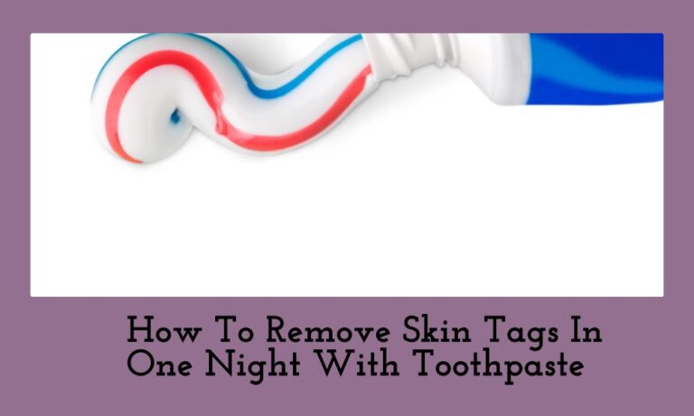 How To Remove Skin Tags In One Night With Toothpaste - Hospital Nino Jesus